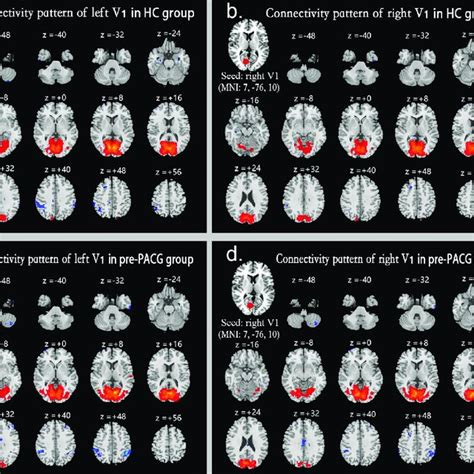 Ifc Spatial Distribution Maps Of V1 Ifc Spatial Distribution Maps Of