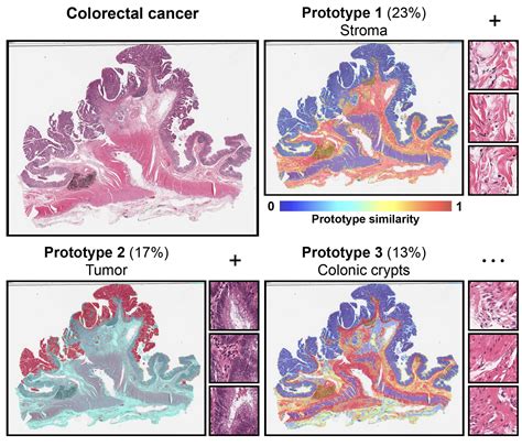 Morphological Prototyping For Unsupervised Slide Representation