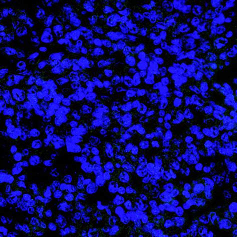 Her2 Efish Probe Accurate Genetic Analysis Omicsveu