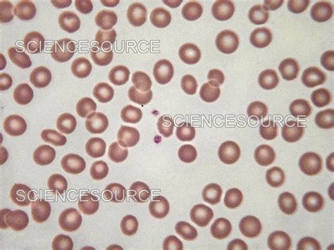 Platelets Under Microscope
