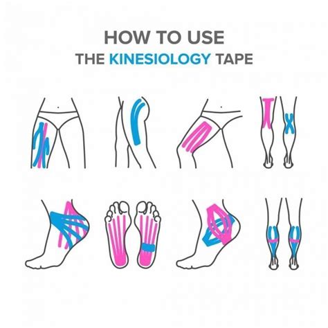 How To Wrap Your Foot With Tape For Plantar Fasciitis At Rafael Gilliam