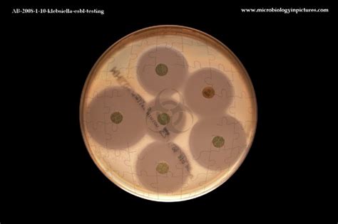 Ab 2008 1 10 Klebsiella Esbl Testing Testing For The Esbl Producing Klebsiella Pneumoniae