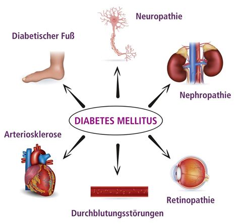 Diabetes Folgeerkrankungen Blutzucker Senken Diabetes Managen De