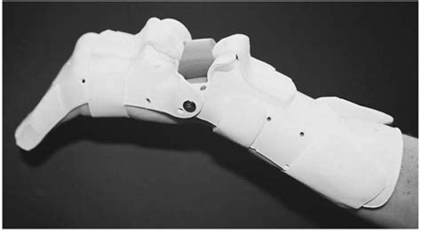 Splinting Plastic Surgery Key
