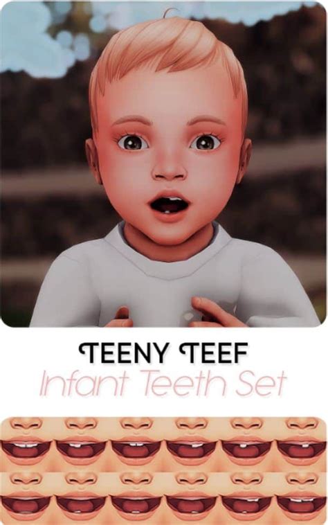 29 Sims 4 Teeth Cc Overbite Braces And Gap Teeth Artofit