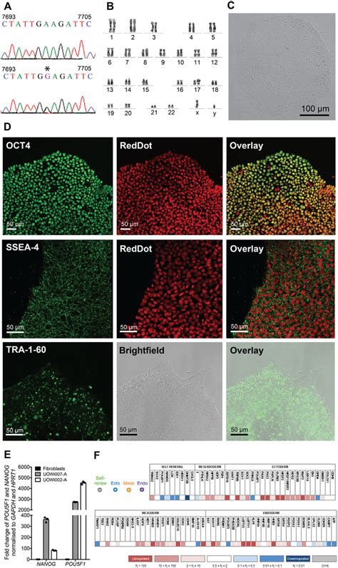 Characterization Of Ipsc Line Uowi007 A Download Scientific Diagram