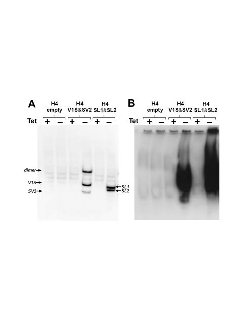 Targeting α Synuclein Oligomers By Protein Fragment Complementation For