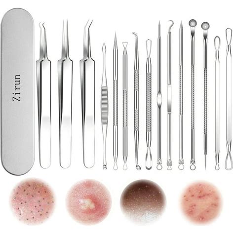 Blackhead Extractors In Skin Care Tools