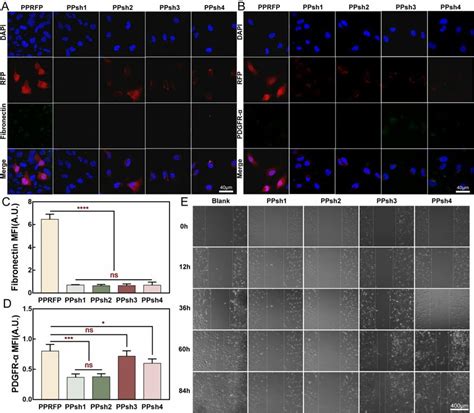 A Immunofluorescence Analysis Of Emt Associated Protein Fibronectin In Download Scientific