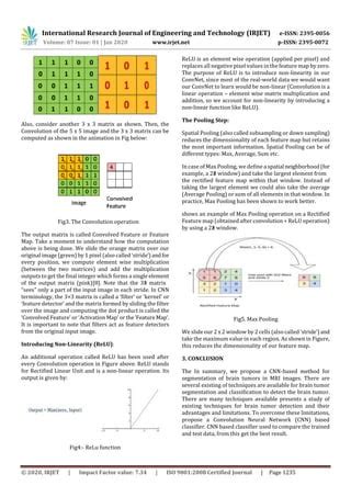 Irjet Brain Tumor Detection Using Convolutional Neural Network Pdf