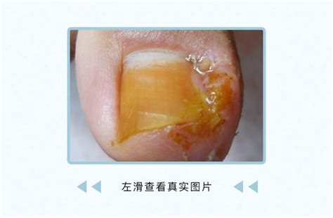 牙膏到底要不要沾水？？ 知乎
