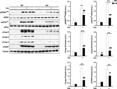 Regulation Of Cerulein Induced Er Stress And Apoptosis By Tcptp Total