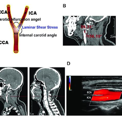 Definition Of Geometric Parameters A Schematic Representation Of Download Scientific