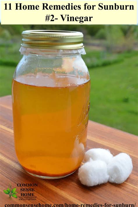 11 Home Remedies For Sunburn Relief Get Rid Of Sunburn