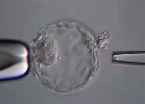 Preimplantation Genetic Testing Pgt Boca Raton And Aventura Fl