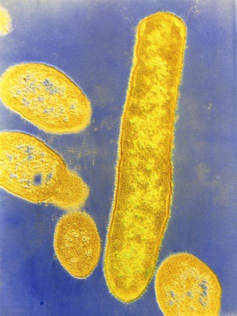 Bacteroides Fragilis Bacteria Photograph By Cnri