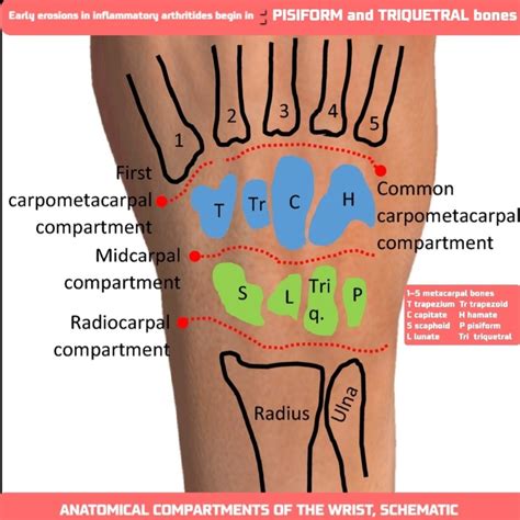 𝐃𝐫 𝐎𝐌𝐈𝐃 𝐁𝐀𝐍𝐃𝐀𝐑𝐂𝐇𝐈 𝐌 𝐃 on Twitter In Rheumatoid arthritis RA