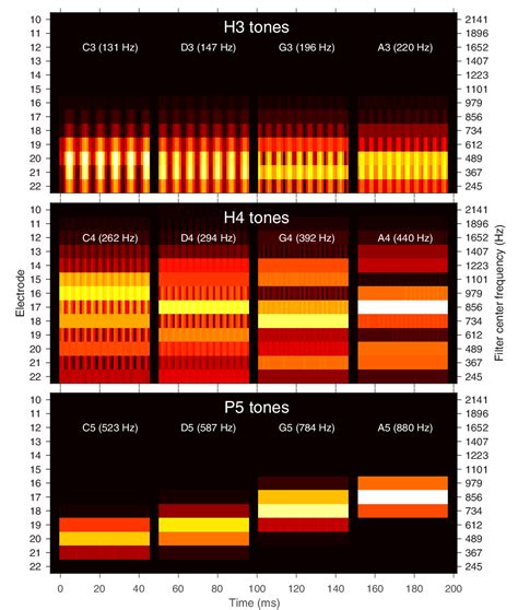 Figure 1 From Place And Temporal Cues In Cochlear Implant Pitch And Melody Perception Semantic
