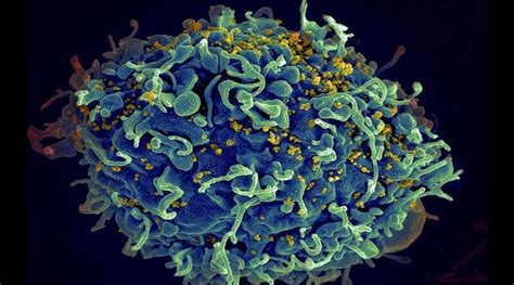 New Lab Test To Detect Persistent Hiv Strains In Africa May Aid Search