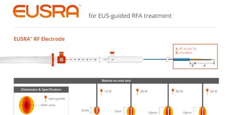 Eusra For Eus Guided Rfa Treatment Reimbursement In Belgium From
