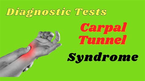 Carpal Tunnel Syndrome Phalens Test Tinels Sign Durkans Test