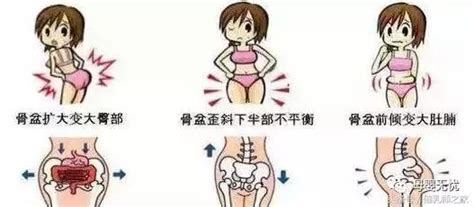 產後屁股下垂都是因為骨盆鬆弛怎麼辦 每日頭條