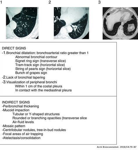 Spanish Guidelines On The Evaluation And Diagnosis Of Bronchiectasis In