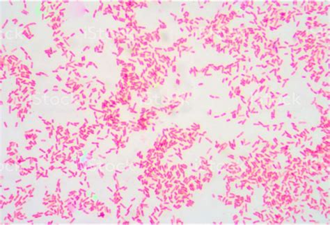 Microbiology Lab Practical Flashcards Quizlet