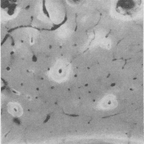 Proximal End Of Tibia Of 186 Day Old Control Download Scientific Diagram