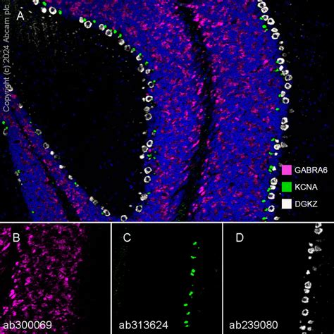 Gaba A Receptor Alpha 6抗体 Epr25322 129 Ab300069 Abcam中文官网
