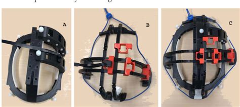 Figure 2 From Improved Biomagnetic Signal To Noise Ratio And Source Localization Using Optically