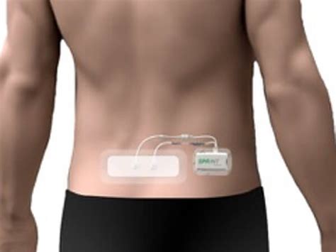 Peripheral Nerve Stimulation Orthonebraska