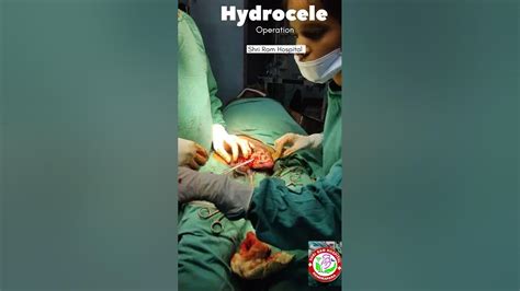 Hydrocele Operation Surgeryday Youtube