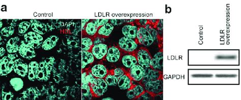 Overexpression Of Low Density Lipoprotein Receptor Ldlr Facilitated Download Scientific