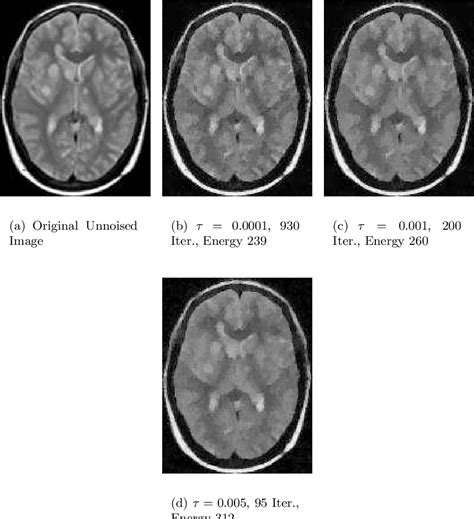 Figure From An E Cid Cient Operator Splitting Method For Noise Removal In Images Semantic