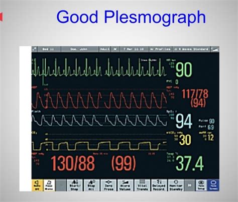 Patho Non Invasive Oxygen Monitoring Flashcards Quizlet
