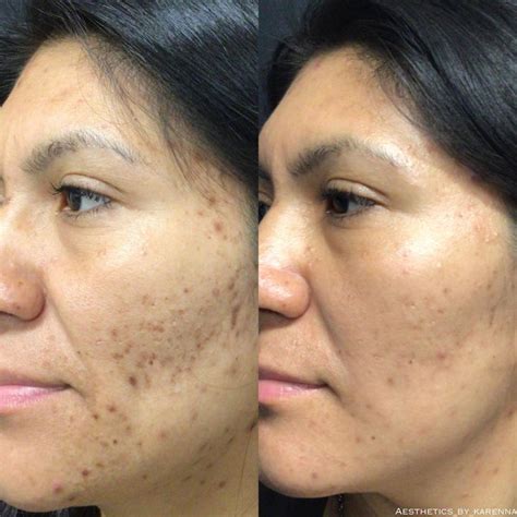 Providing Care For Dermatology Concerns And Treatments Of Asian Skin