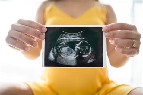 Nub Theory What Is It And How It Predicts Your Babys Sex At 12 Weeks