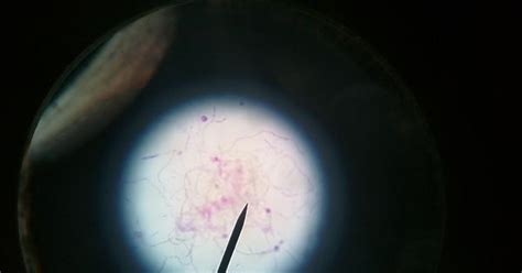 lab 1 practical slides album on imgur