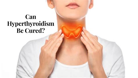 Can Hyperthyroidism Be Cured