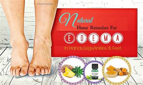 17 Home Remedies For Edema In Hands Legs Ankles And Feet