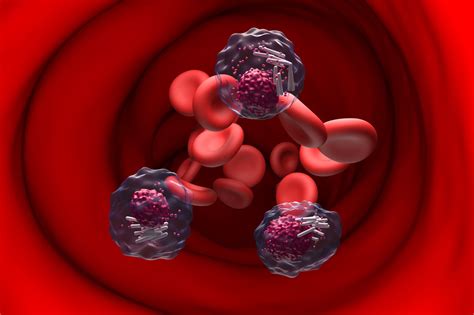 As Many As 40 Of Cll Patients Dont Need Specialized Follow Up Data