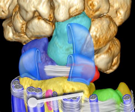 Wrist Compartment Three Graphic Sonosite Institute For Point Of Care Ultrasound