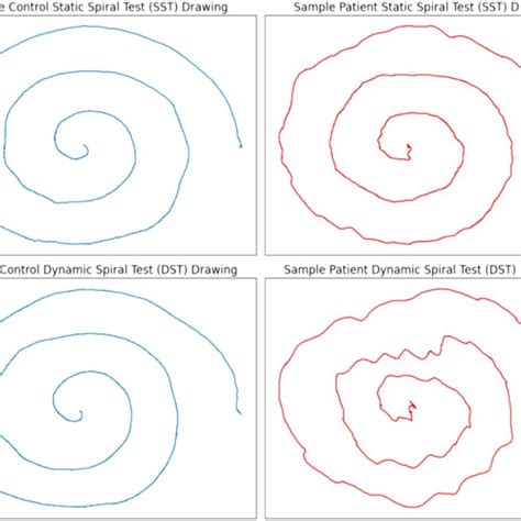 samples of static and dynamic spiral drawings of control left blue