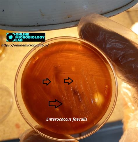 نمای همولیز آلفا Alpha Hemolysis آزمایشگاه مجازی میکروب شناسی