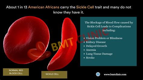 Bmt Clinic About 1 In 13 African Americans Carry The Sickle Cell Trait And Many Do Not Know