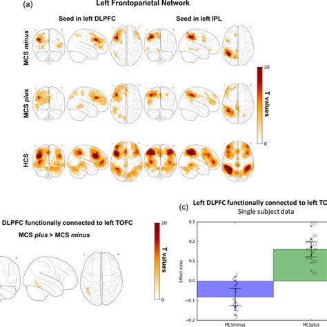 Correlation Between The Mpfc Left Column Pcc Right Column And The