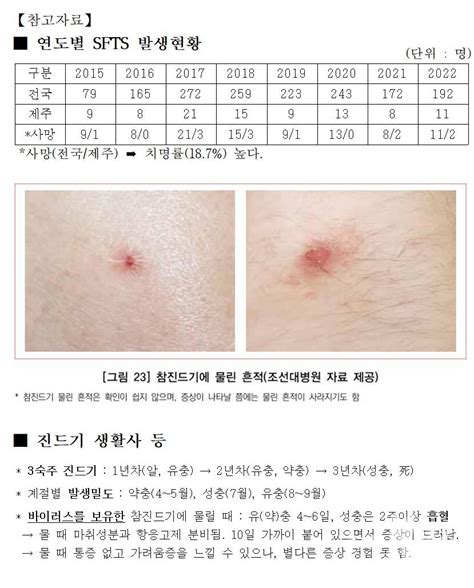 서부보건소 진드기 매개 감염병 주의 당부 뉴스n제주