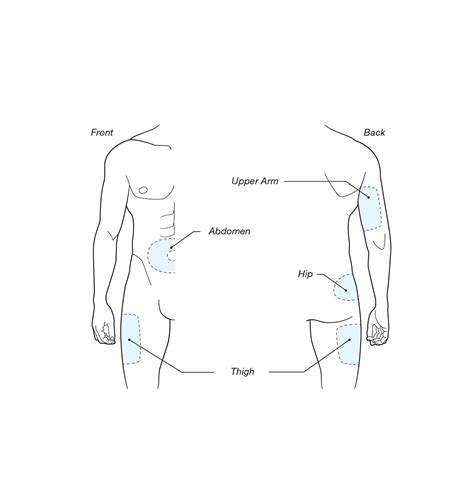 Subcutaneous Sq Injection Instructions Empower Pharmacy