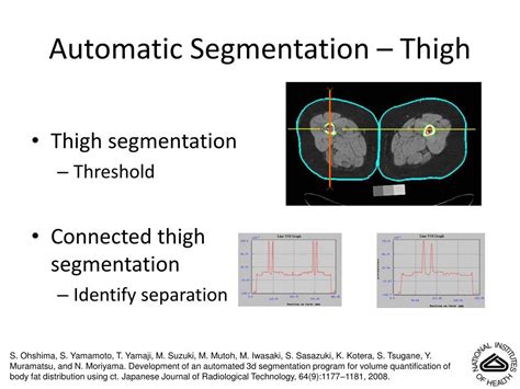 ppt automated segmentation of computed tomography images powerpoint